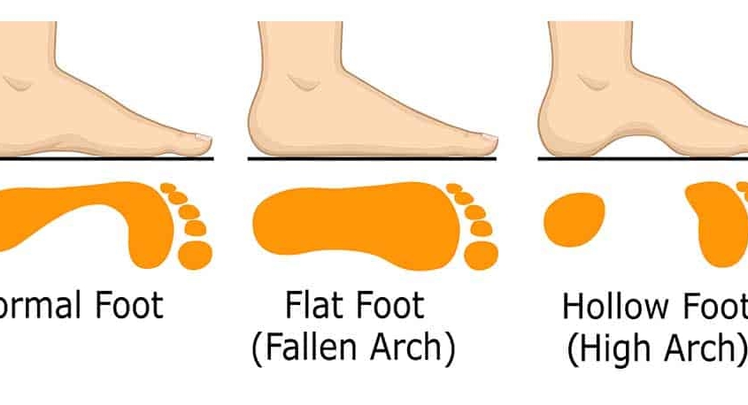 Medical Test - Defence Care